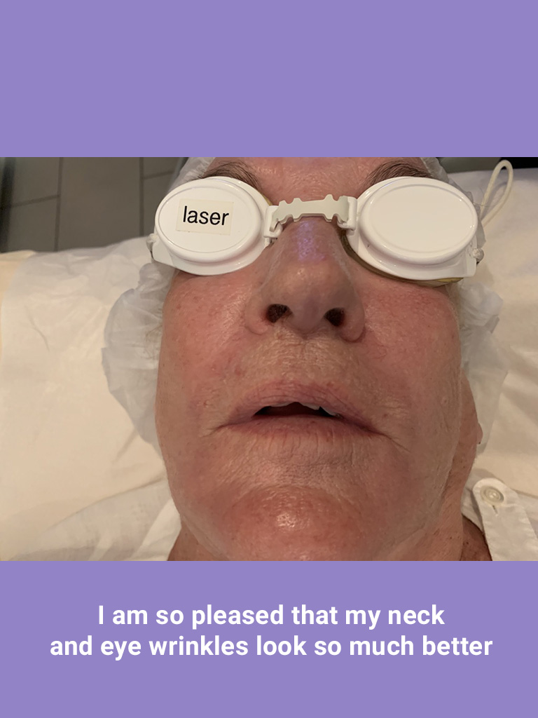 Skin Tightening and Rejuvenation - Harmony XL Pro Treatments ...